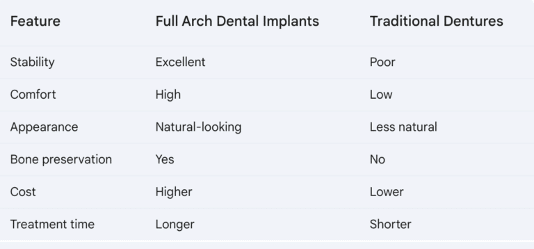What are Full Arch Dental Implants? Advice from experts