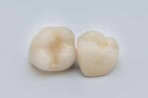 What is the Best Type of Dental Crowns Material?