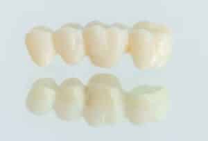 What color are dental crowns? Guidance experts dentistry