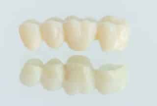 What color are dental crowns? Guidance experts dentistry